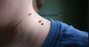 Wajahmu Kutilan, Don't Worry, Ini Tipsnya...! - MalangVoice